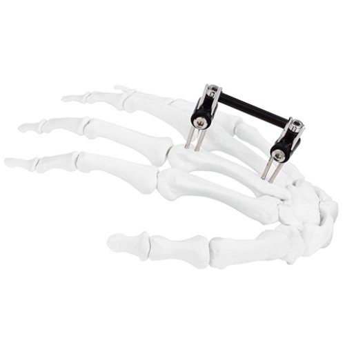 Mini Fragment External Fixator (Finger and Palm) - Orthopedic Drills UK